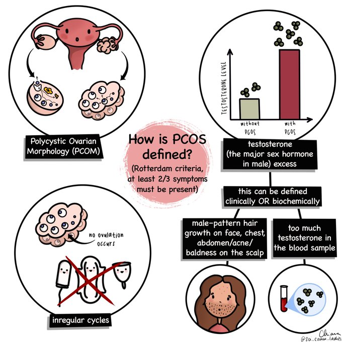 Research – DAISy-PCOS